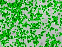 SCCOHT-1 Human Small Cell Carcinoma Ovarian Cell Line | SCC437